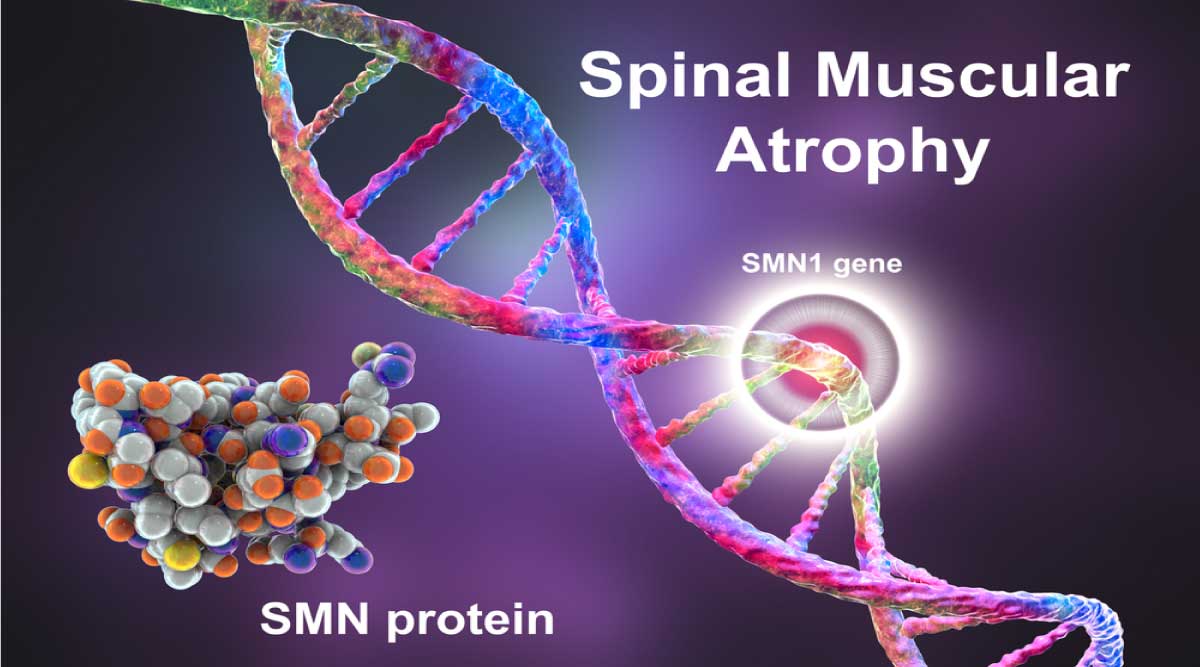 Spinal Muscular Atrophy Prevention | SMA Cure | Patient Teacher
